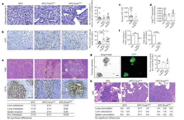 Science子刊：肿瘤细胞EMT的本质终于搞清楚了 - 黄灿华教授 实验室